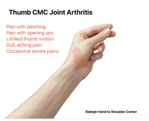 Thumb CMC Arthritis - Raleigh Hand to Shoulder Center