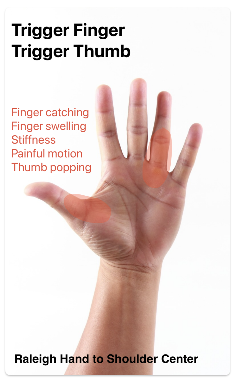 Trigger Finger - Raleigh Hand to Shoulder Center