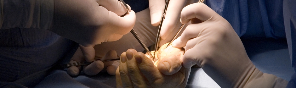 History of Hand Surgery in the US - Raleigh Hand to Shoulder Center